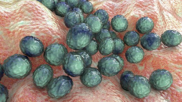 Staphylococcus saprophyticus qPCR assay - PCR Assays